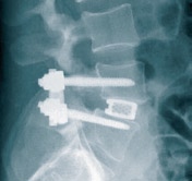 HOME Hospital